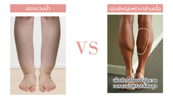 ลดน่อง ที่ได้ผลจริง ต้องทำแบบไหน รวมทุกเทคนิคแล้ว ที่นี่เลย - Estique ...